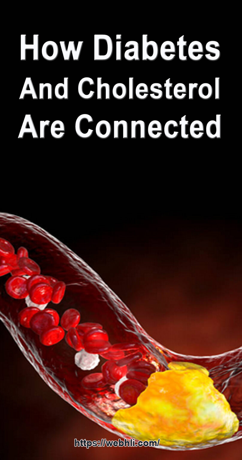 How Diabetes And Cholesterol Are Connected | Healthy Lifestyle