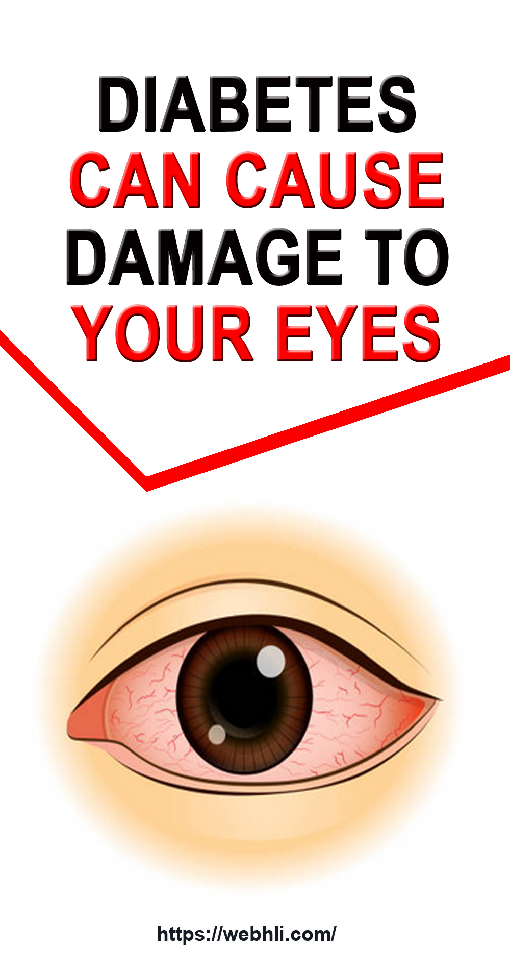 Diabetes Can Cause Damage to Your Eyes | Healthy Lifestyle