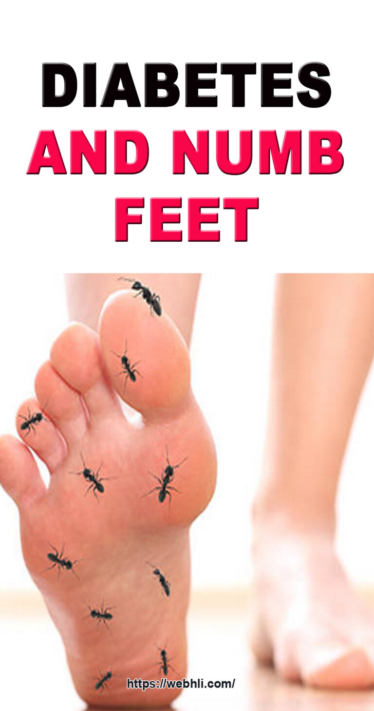 Diabetes and Numb Feet | Healthy Lifestyle