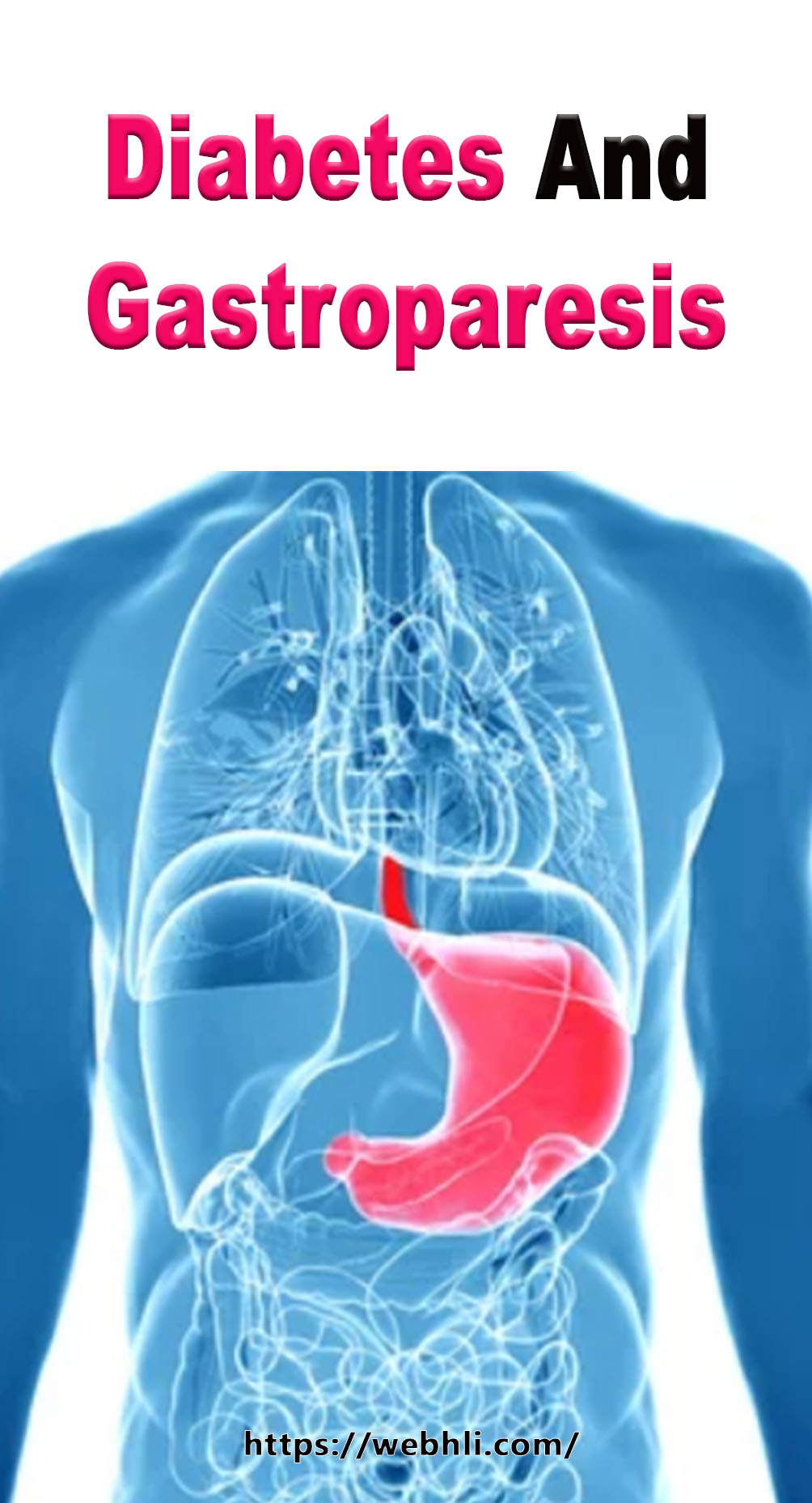 Diabetes And Gastroparesis | Healthy Lifestyle