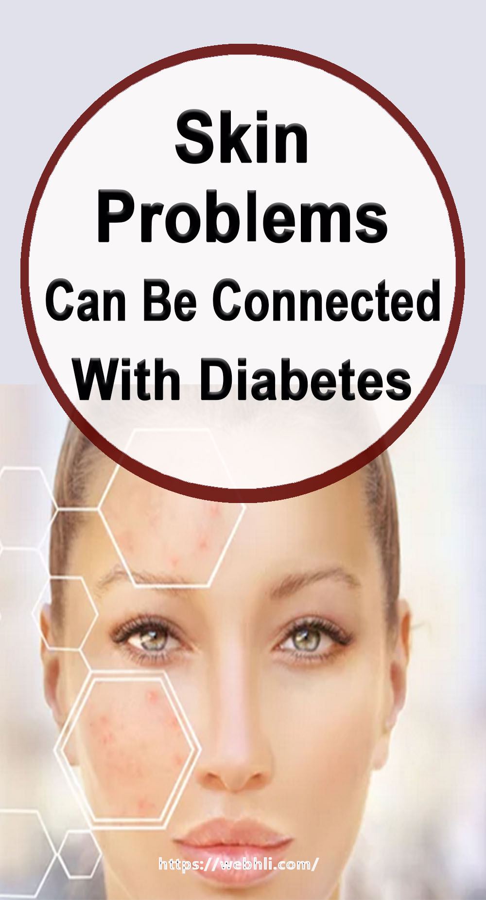 Skin Problems Can Be Connected With Diabetes | Healthy Lifestyle