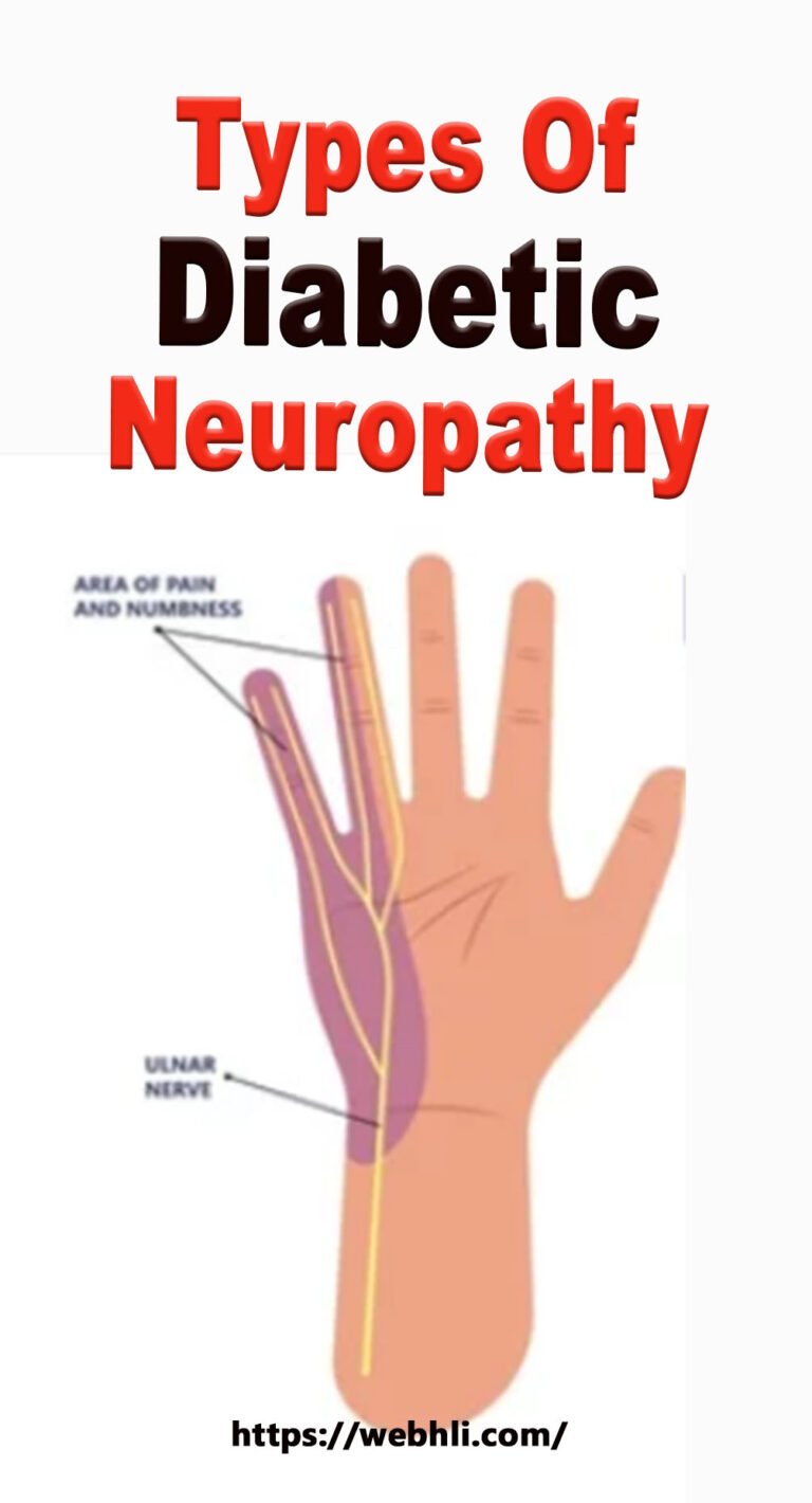 Types Of Diabetic Neuropathy | Healthy Lifestyle