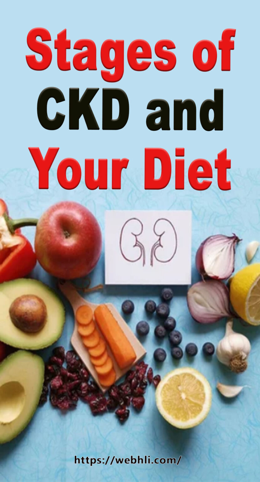 Stages of CKD and Your Diet | Healthy Lifestyle