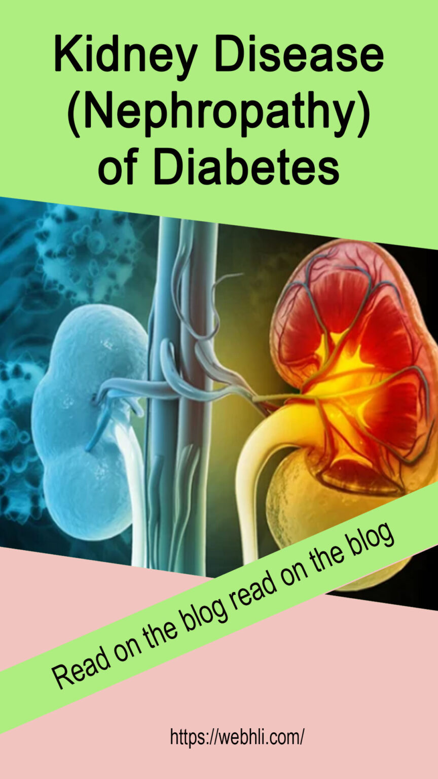 Kidney Disease (Nephropathy) of Diabetes | Healthy Lifestyle
